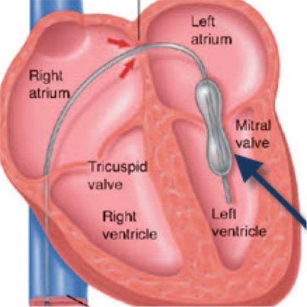 Procedimentos - CARDIOin Cateterismo